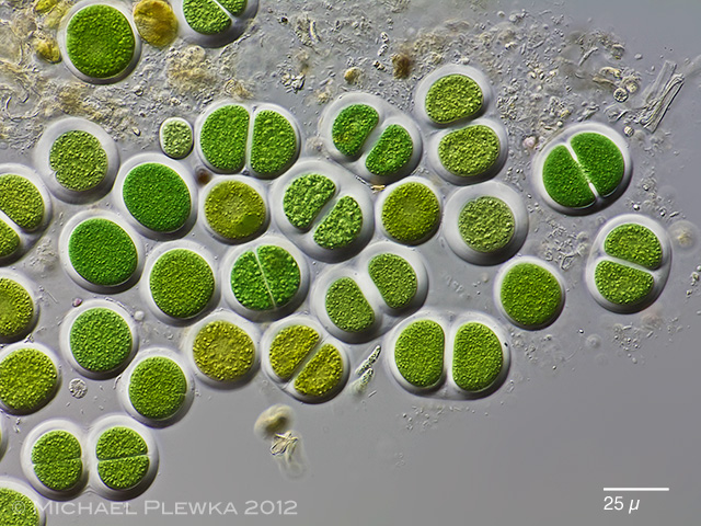 Stefansbachtal Gevelsberg: Leben im Teich: Kugelblaualge (Chroococcus turgidus) (Cyanobacteria)